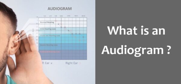 What is an Audiogram? - Ratmalana Audiology Centre